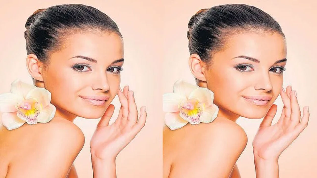 మొటిమల మచ్చలు మాయం | Scars on the face disappear ms spl