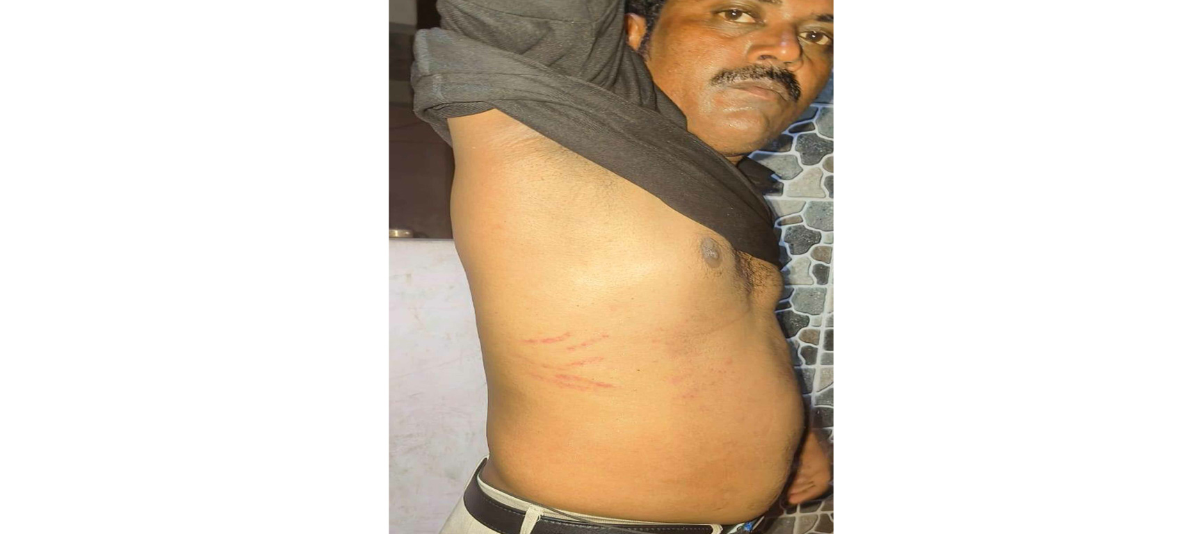 టీడీపీ కార్యకర్తపై వైసీపీ నేతల మూక దాడి | On TDP worker Gang attack by ...