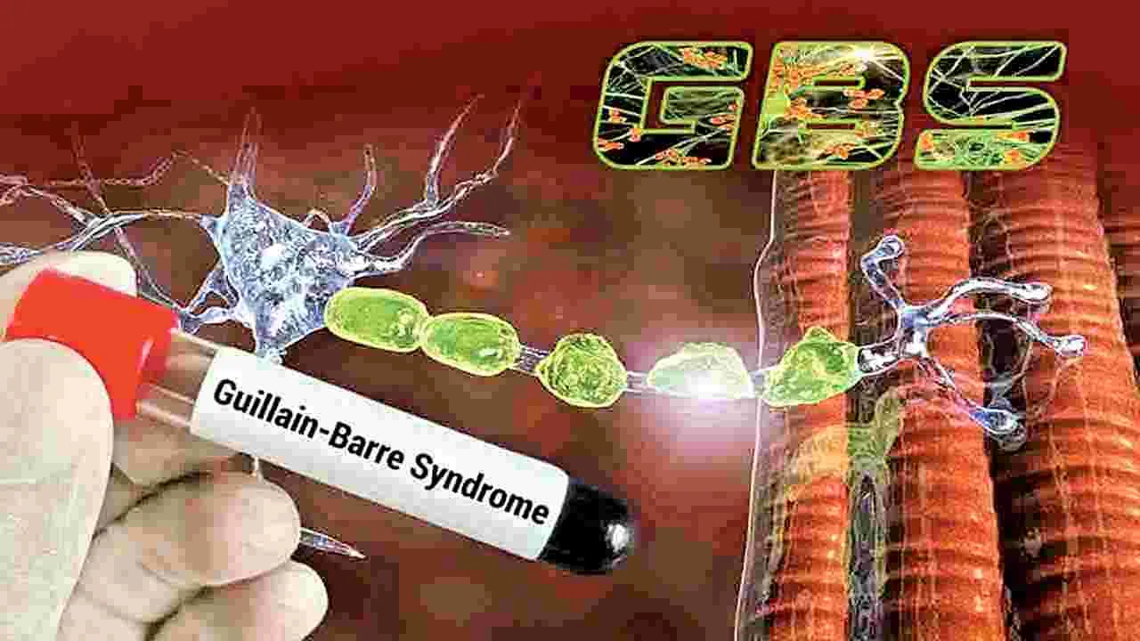 జీజీహెచ్‌లో జీబీఎస్‌..! | GBS in GGH..!